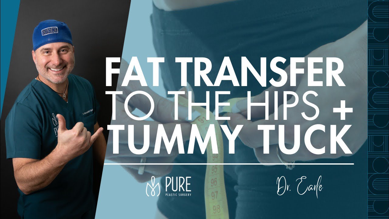 Fat Transfer to the Hips + Tummy Tuck: A Powerful Combination - YouTube