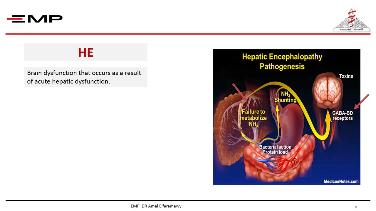 Acute Liver Disease Segment 5 Youtube