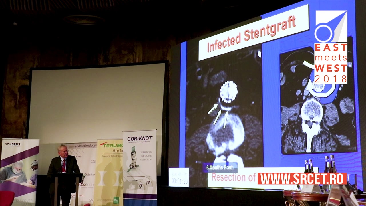 EMW 2018 Martin Malina 3 - YouTube