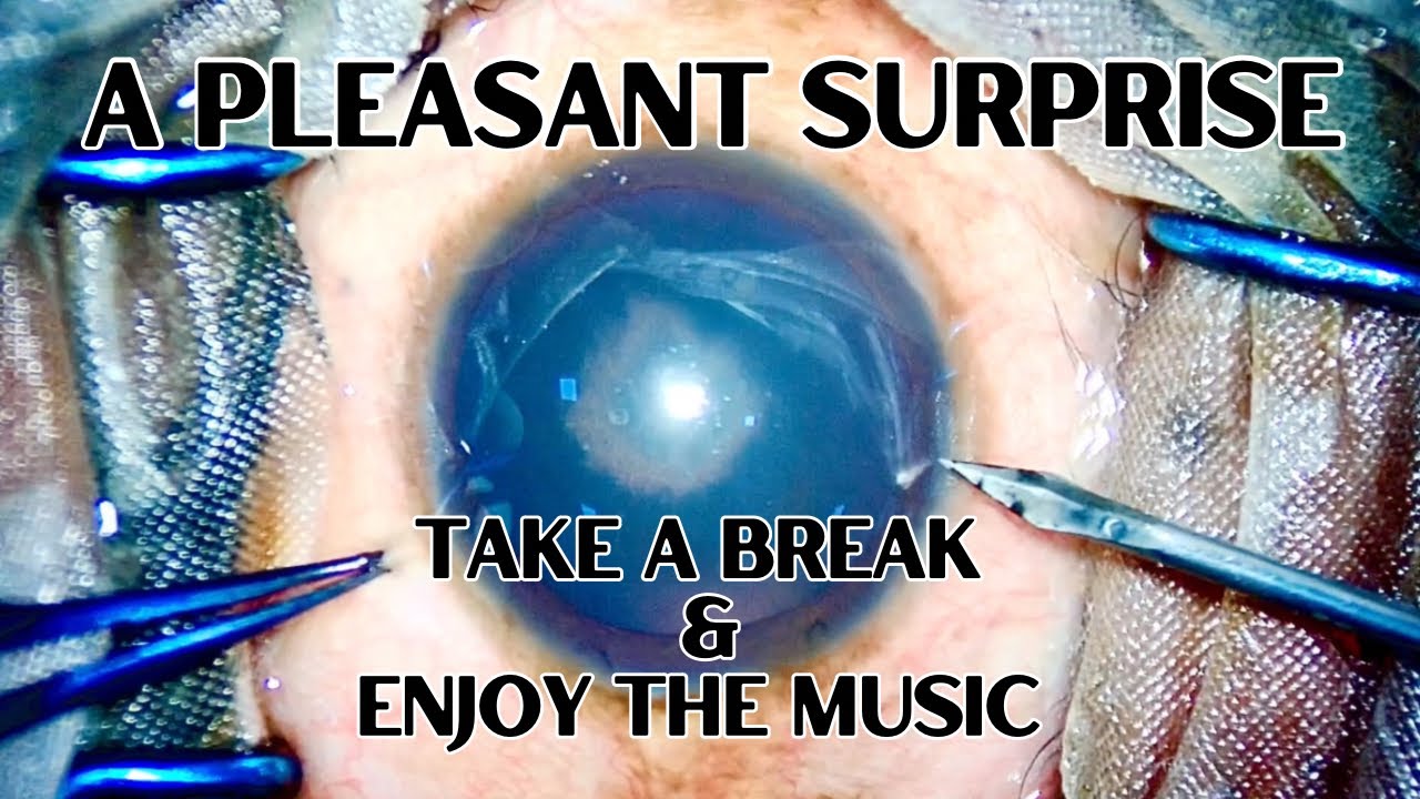 An efficient 5 minute surgery , take a break , put your headphones and ...