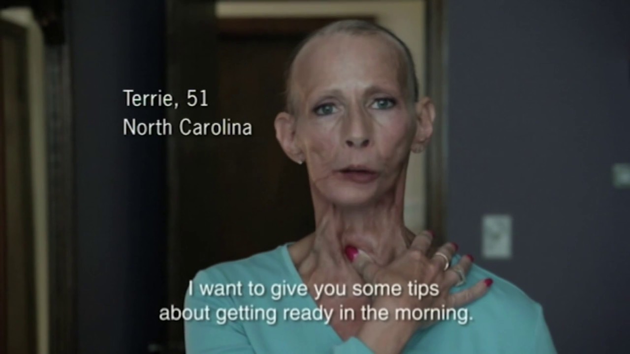 Quitline - Tips From Former Smokers - Terrie's Tip TV Commercial 2012 ...