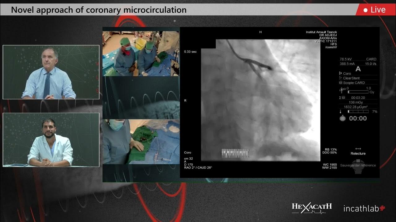 Microcirculation Clinical Cases with RayFlow by Hexacath 2021 - YouTube