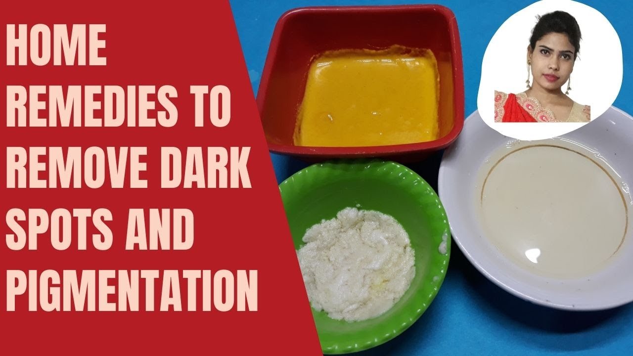 How to Remove Dark Spots and Pigmentation from Face at home. Face care ...