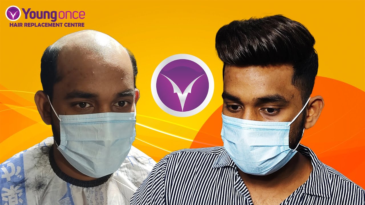 "Regain your confidence with our non-surgical hair solutions! 🌟💇 # ...