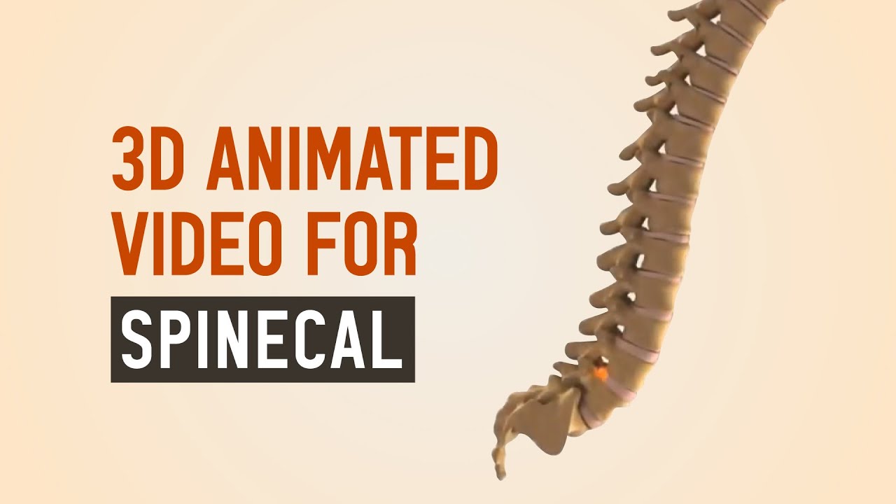 Animated Video For Disc Herniation - SpineCal Orthopedic Institute ...
