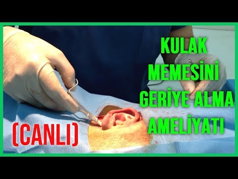 Kulak Memesini Geriye Alma Ameliyatı (CANLI)👍😍👂