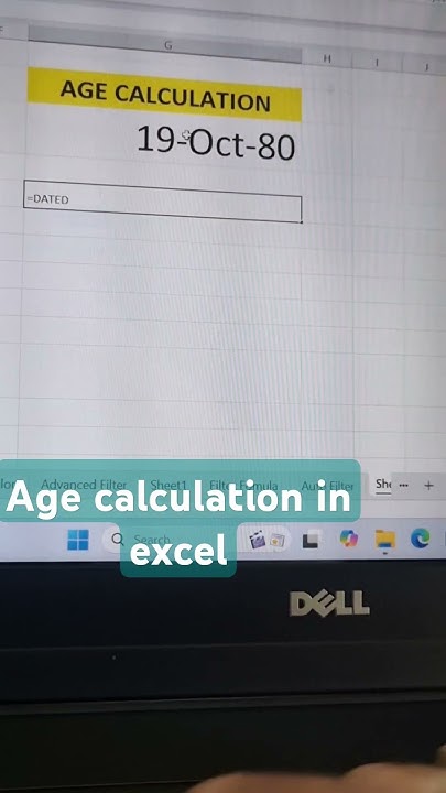 How to Age calculate in excel @excel #shorts# #newexcel #excelsolution #calculas @ictcomputers ...