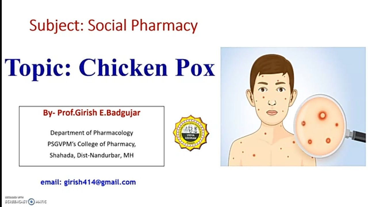 Chicken pox: Causative agent, Symptoms, Prevention and control #Social ...