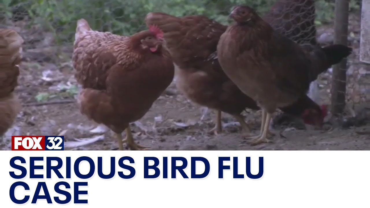 Across America: First patient with severe bird flu case reported - YouTube