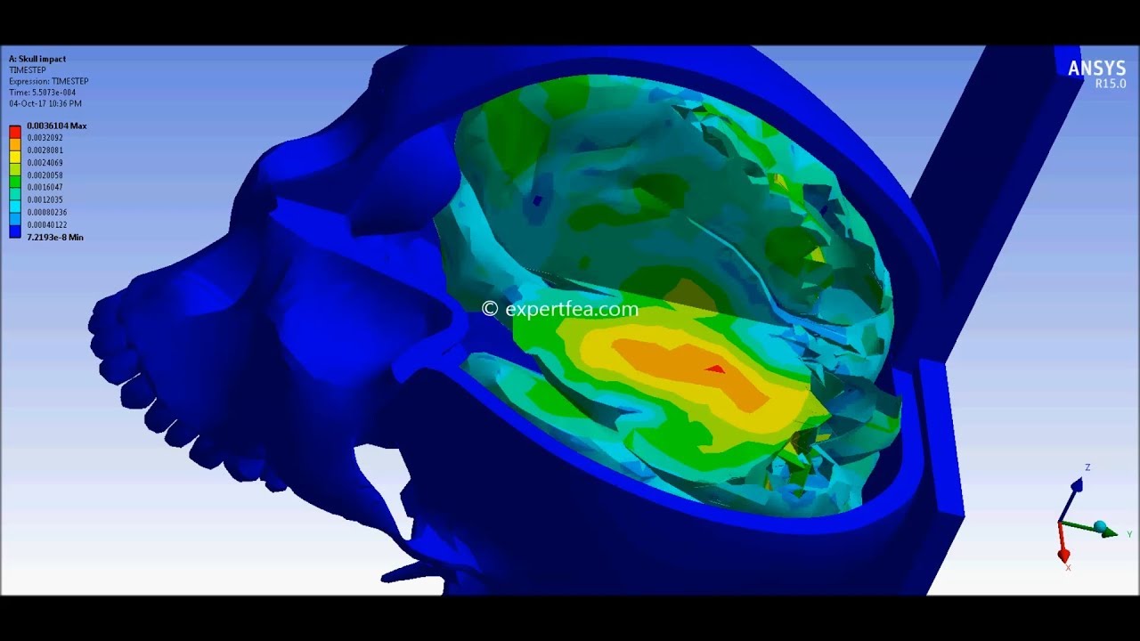 ANSYS WB Explicit Dynamics FEA - Simulation of impact between a skull ...
