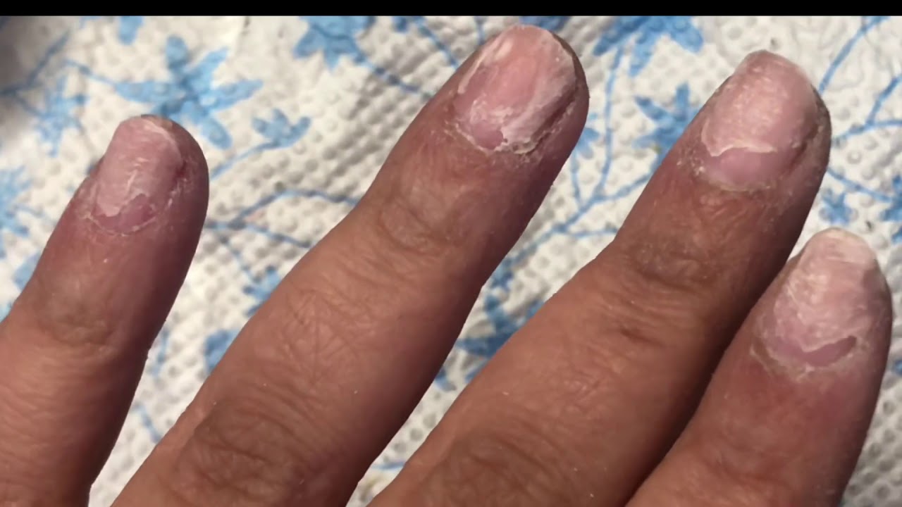 How to remove poly gel nails at home - YouTube