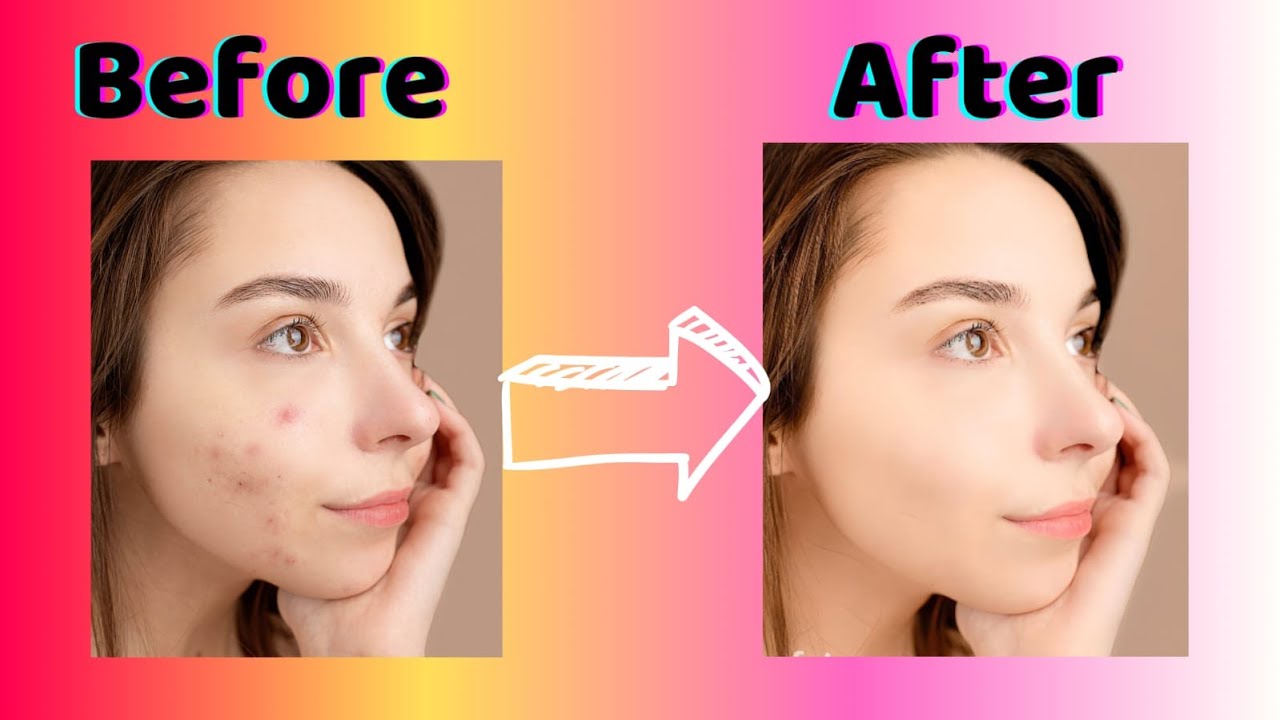 Fotor অ্যাপ দিয়ে মুখের দাগ-ছোপ দূর করুন | Kibhabe Mukher Dag Dur ...