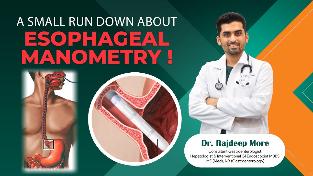 A Small Run Down About Esophageal Manometry | Dr Rajdeep More ...
