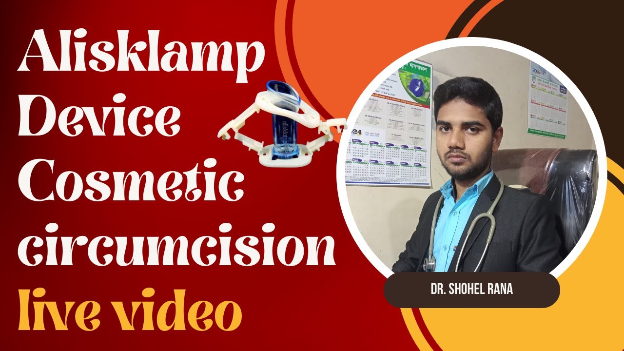 100% save and painless Alisklamp Device Cosmetic circumcision | Trust ...