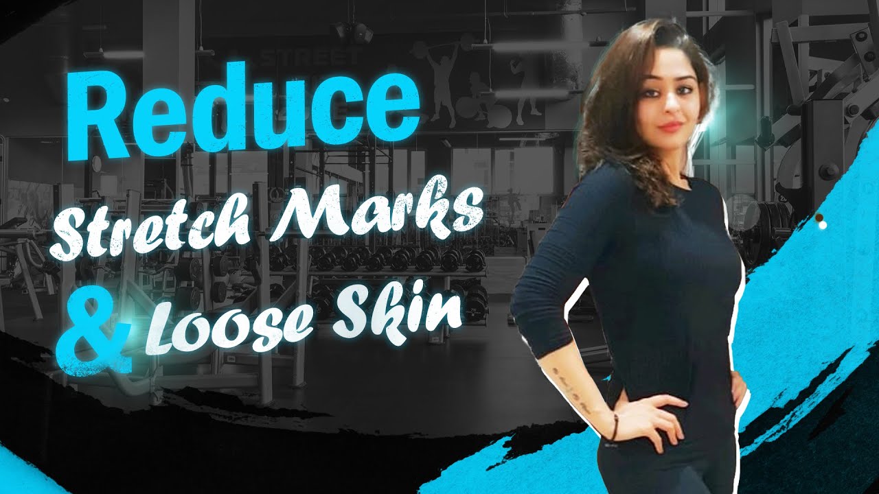 Tips to Reduce Stretch Marks & Loose Skin - YouTube