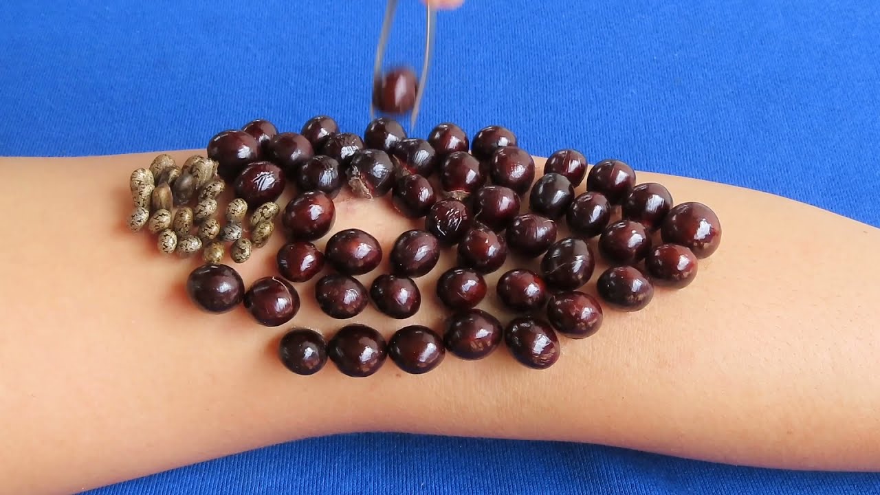 [ Giant ticks ] How to remove very big ticks style on arm | Designed ...