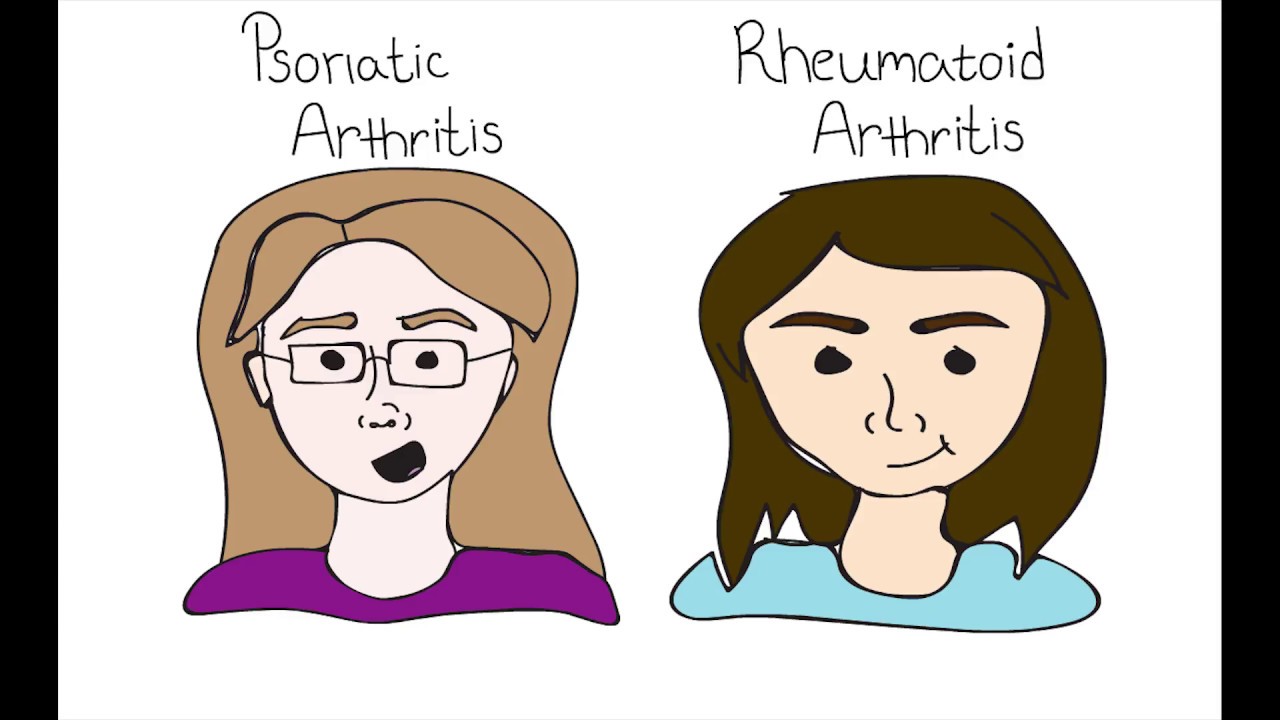 Rheumatoid Factors - YouTube