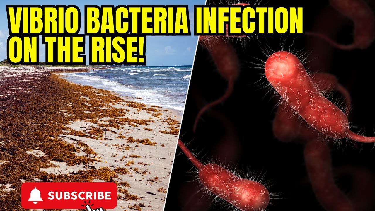 Vibrio Infections: What You Need to Know! - YouTube