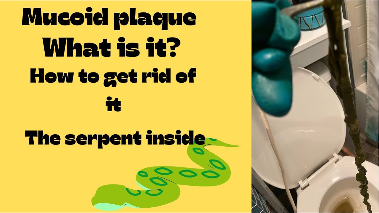 #juice cleanse#livingfood #mucoid plaque fifty five days juice cleanse ...