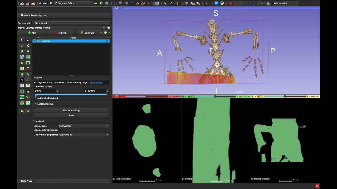 3D Slicer - Segment Geometry Demo - YouTube