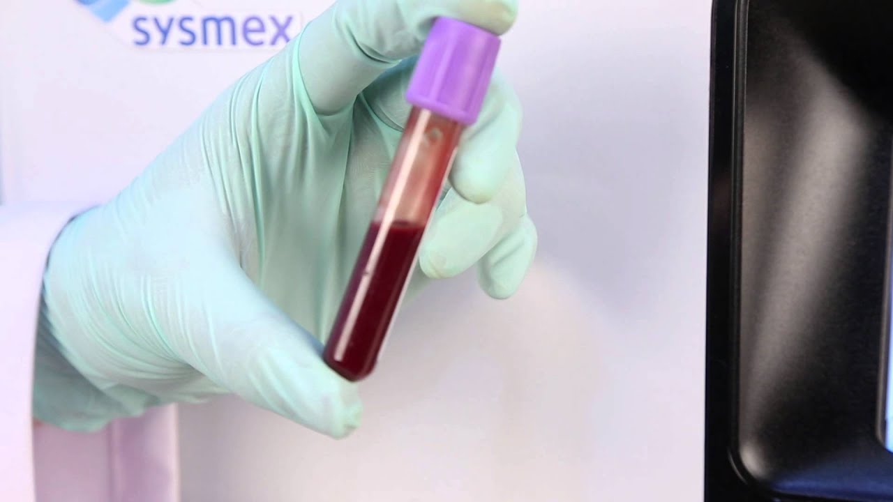 Sysmex XP-Sereis, 5a. Analisis Sampel dengan mode Whole Blood (WB mode ...