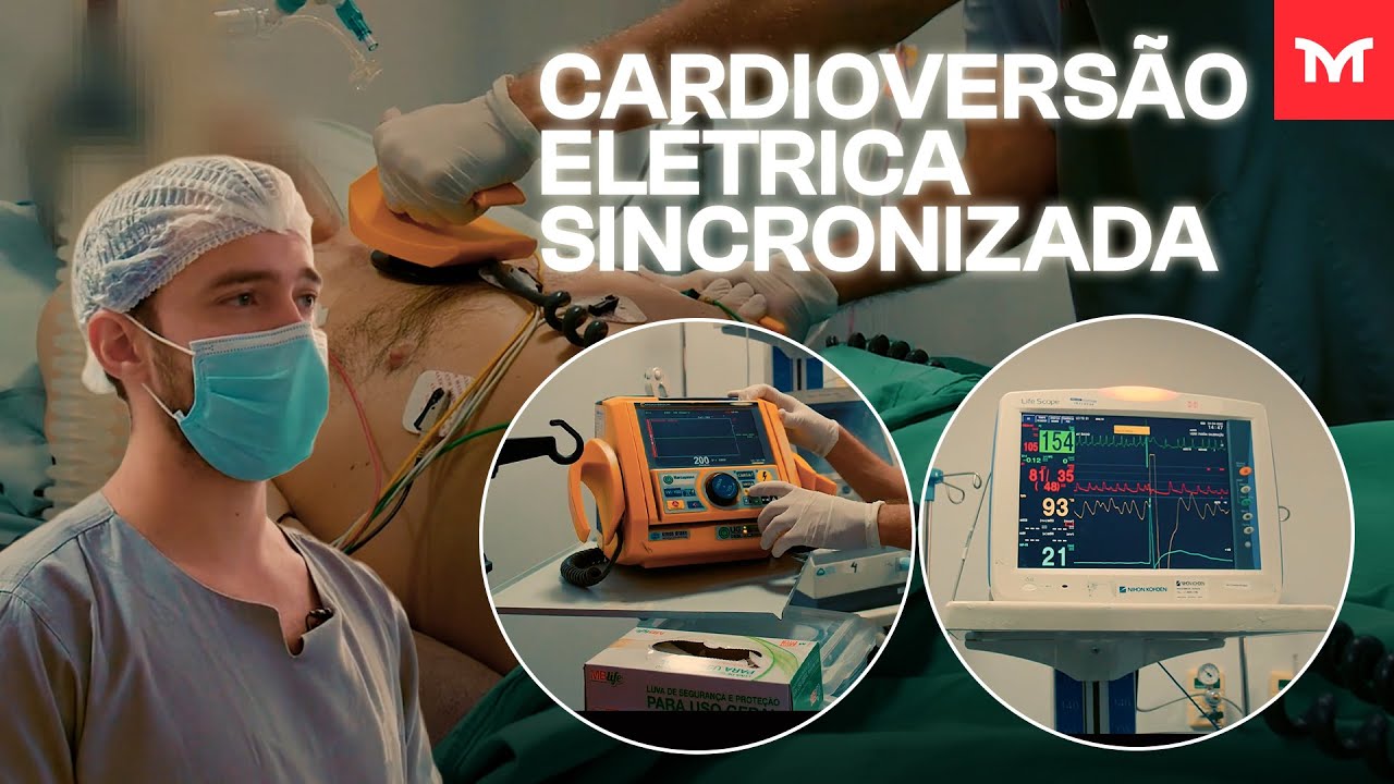 Cardioversão em Fibrilação Atrial: Técnicas de Choque Elétrico e ...