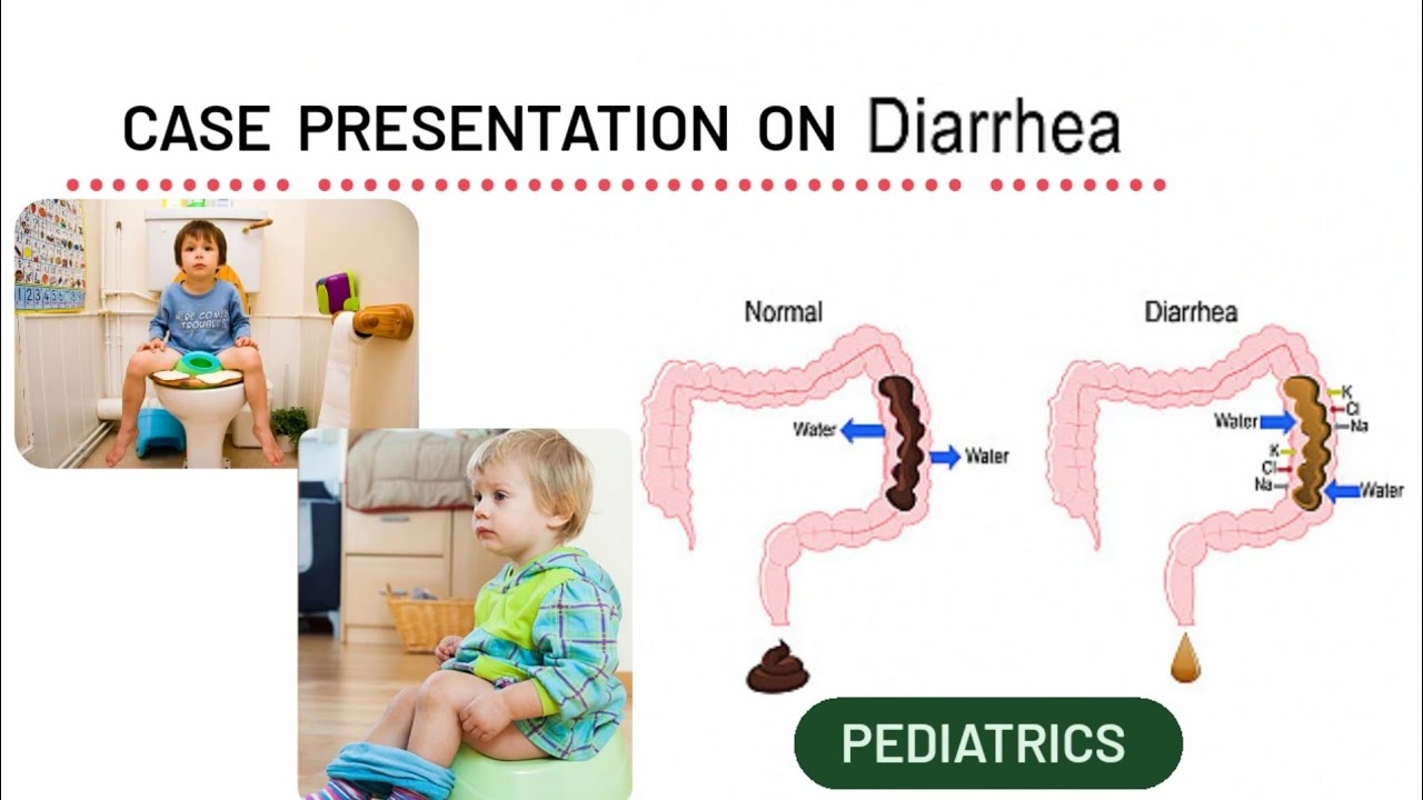 Case presentation on 'DIARRHOEA' // #diarrhoea // #nursing - YouTube