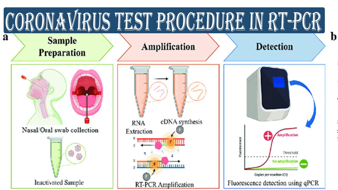 Coronavirus Test Procedure।। Coronavirus Test Procedure in RT-PCR Step ...
