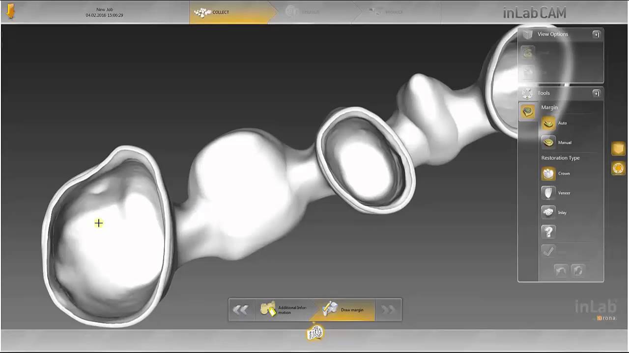 Optimize Your Digital Workflow: STL Import into inLab CAM SW 15 ...
