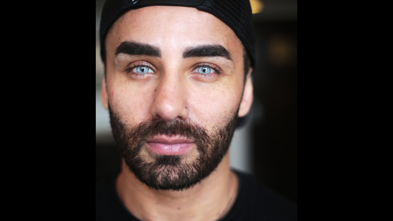 Permanent eye color change procedure - Brightocular - YouTube