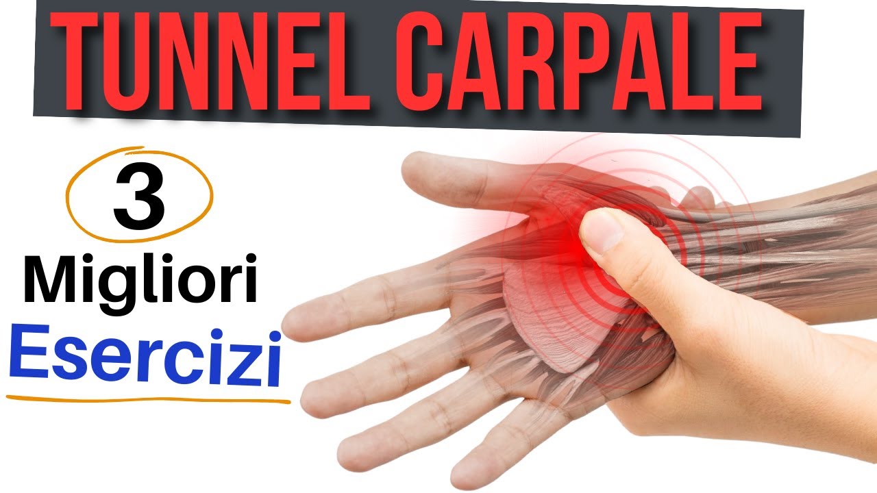 Tunnel Carpale: i 3 Migliori Esercizi - YouTube
