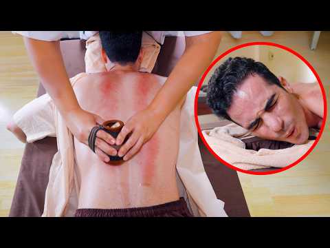 ASMR: Göz Spa ile Muhteşem Çin Basınç Noktası Guasha Moxibustion Sırt Masajı