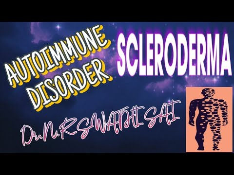 AUTOIMMUNE DISEASE - SCLERODERMA - CLINICAL FEATURES #autoimmune - YouTube