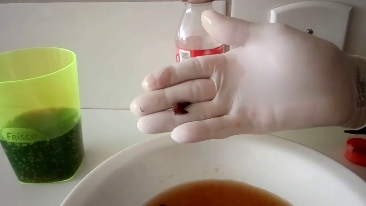 EFEITO DA COCA COLA NOS DENTES - APÓS UM MÊS (COCA'S EFFECT FILLED IN ...