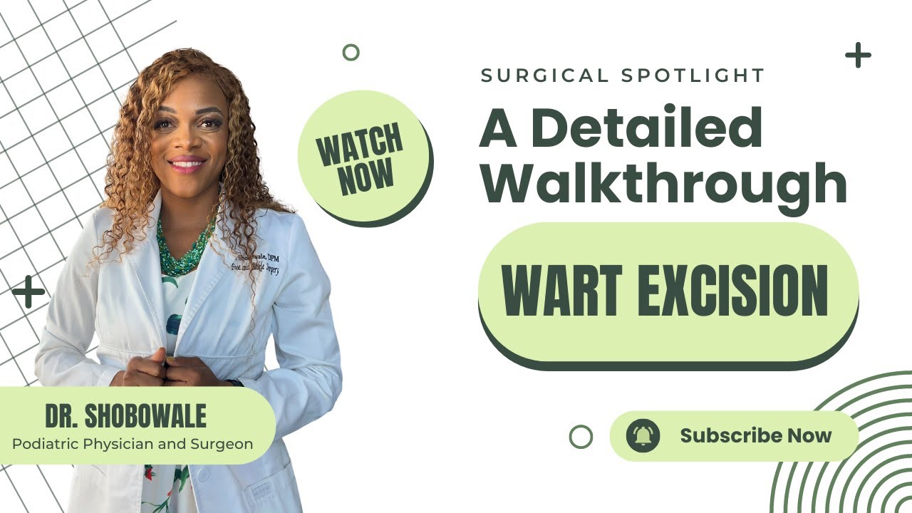 WART EXCISION PROCESS FROM BEGINNING TO END - YouTube