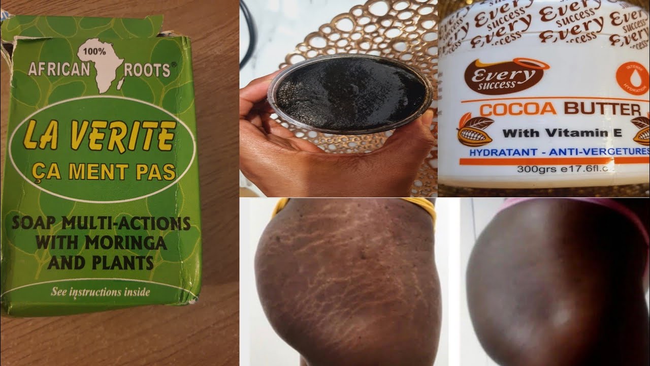 SEULEMENT 3 PRODUITS POUR TRAITER LES VERGETURES, SAVON, GOMMAGE ...