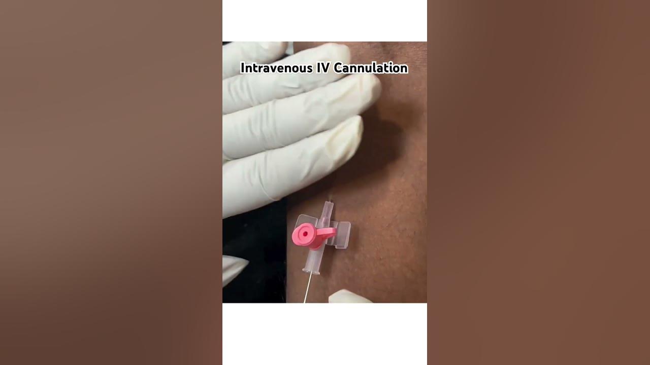 Intravenous IV Cannulation IV Cannulation technique IV cannula insertion how to insert iv ...