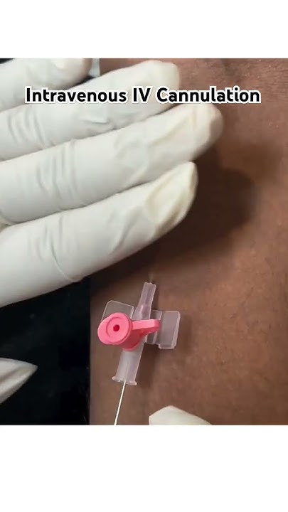 Intravenous IV Cannulation IV Cannulation technique IV cannula insertion how to insert iv ...