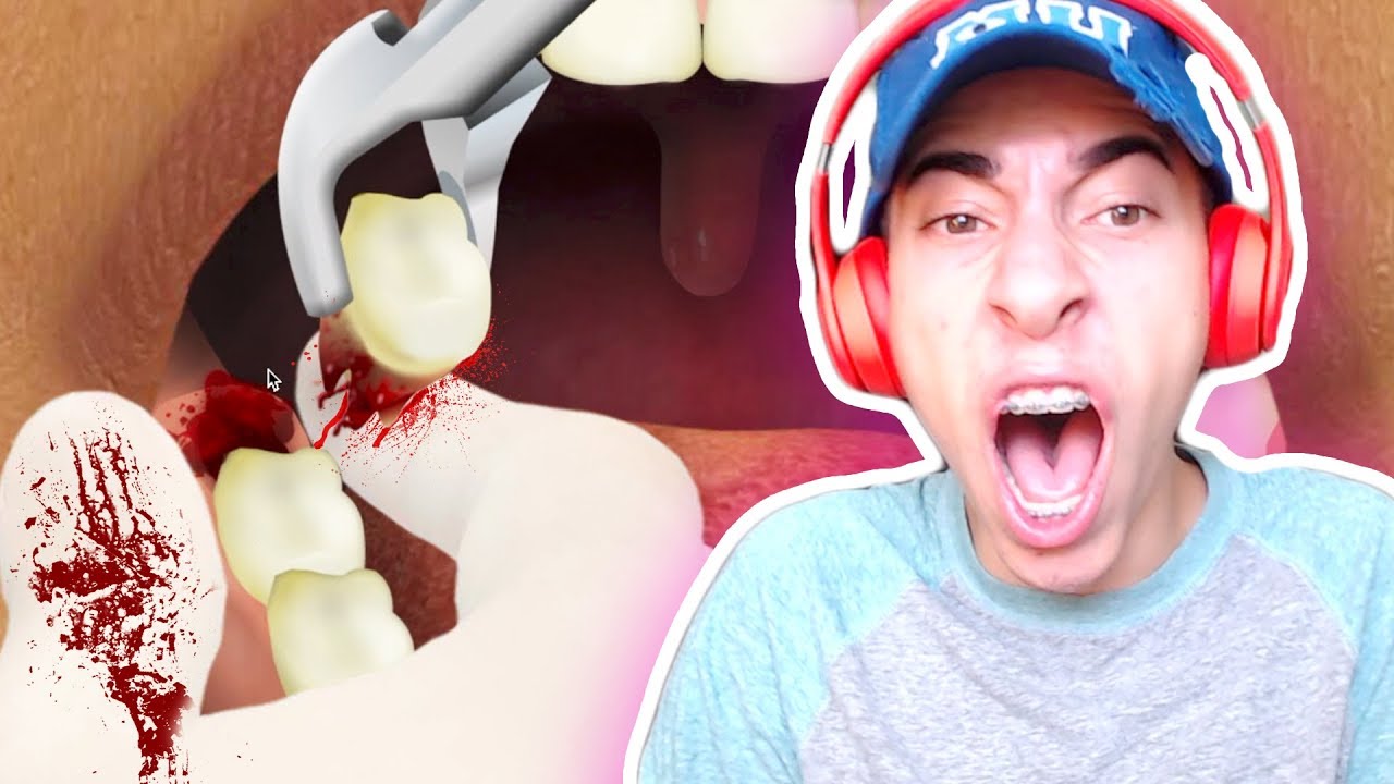 Wisdom Teeth Removal Gone Wrong