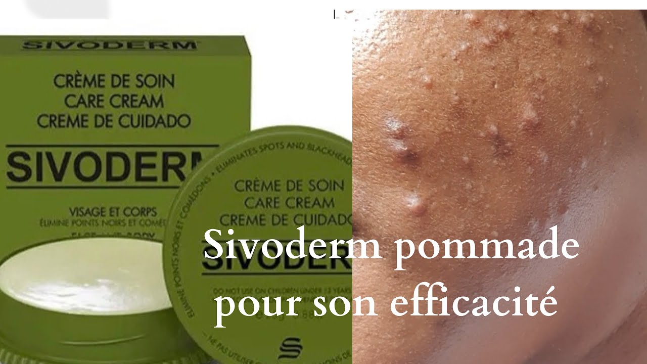 Pourquoi j’ai utilisé sivoderm pommade sur mon visage . Mon avis - YouTube