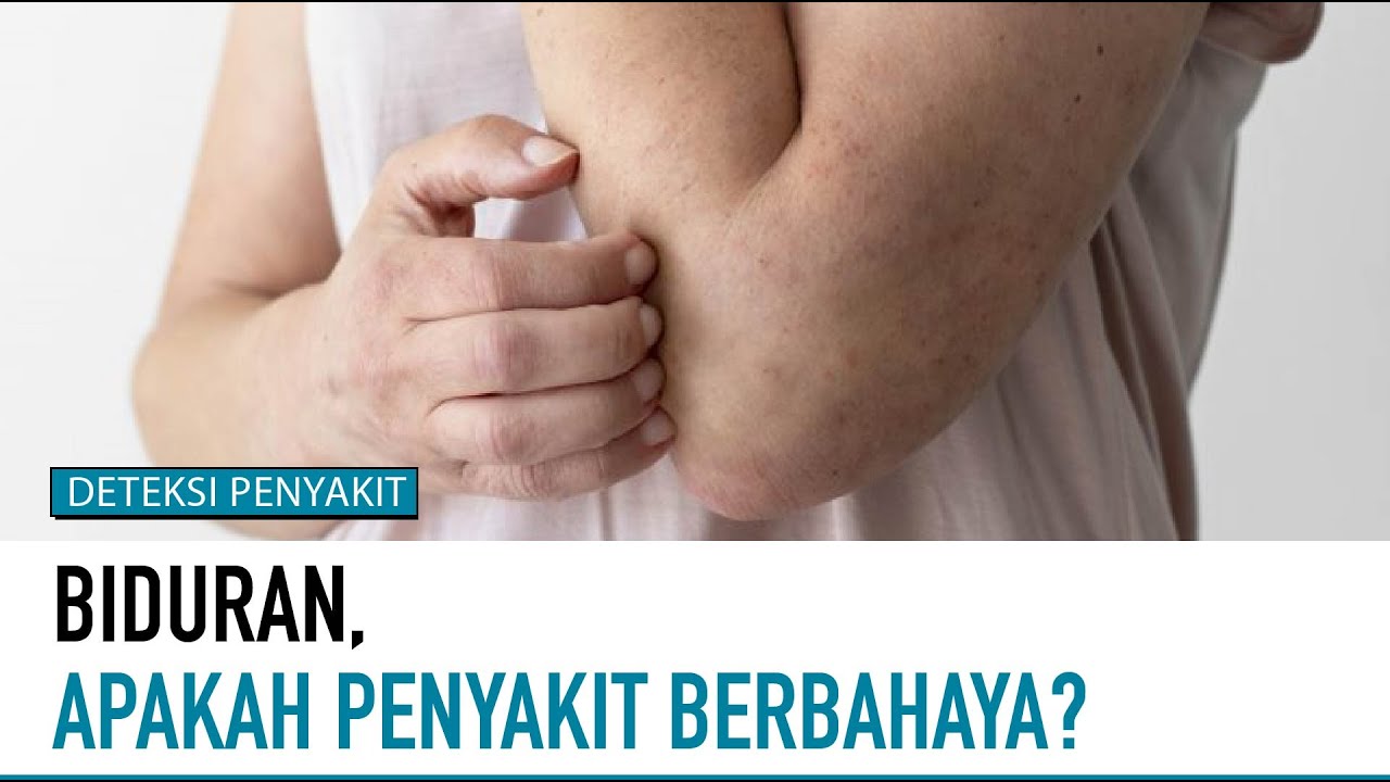 Apakah Biduran Penyakit yang Berbahaya? | Deteksi Penyakit - YouTube