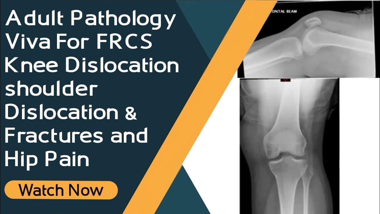 Adult Pathology viva For FRCS - YouTube