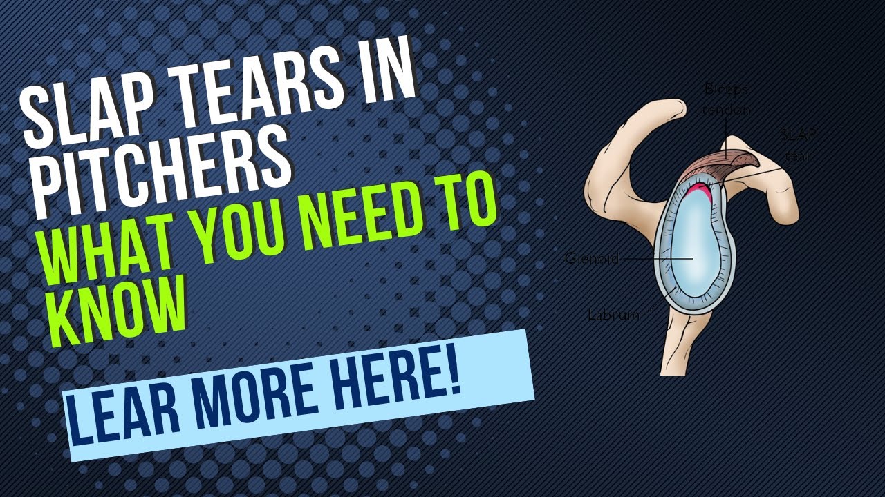 How to Identify Shoulder Labrum Tears in Throwers - YouTube