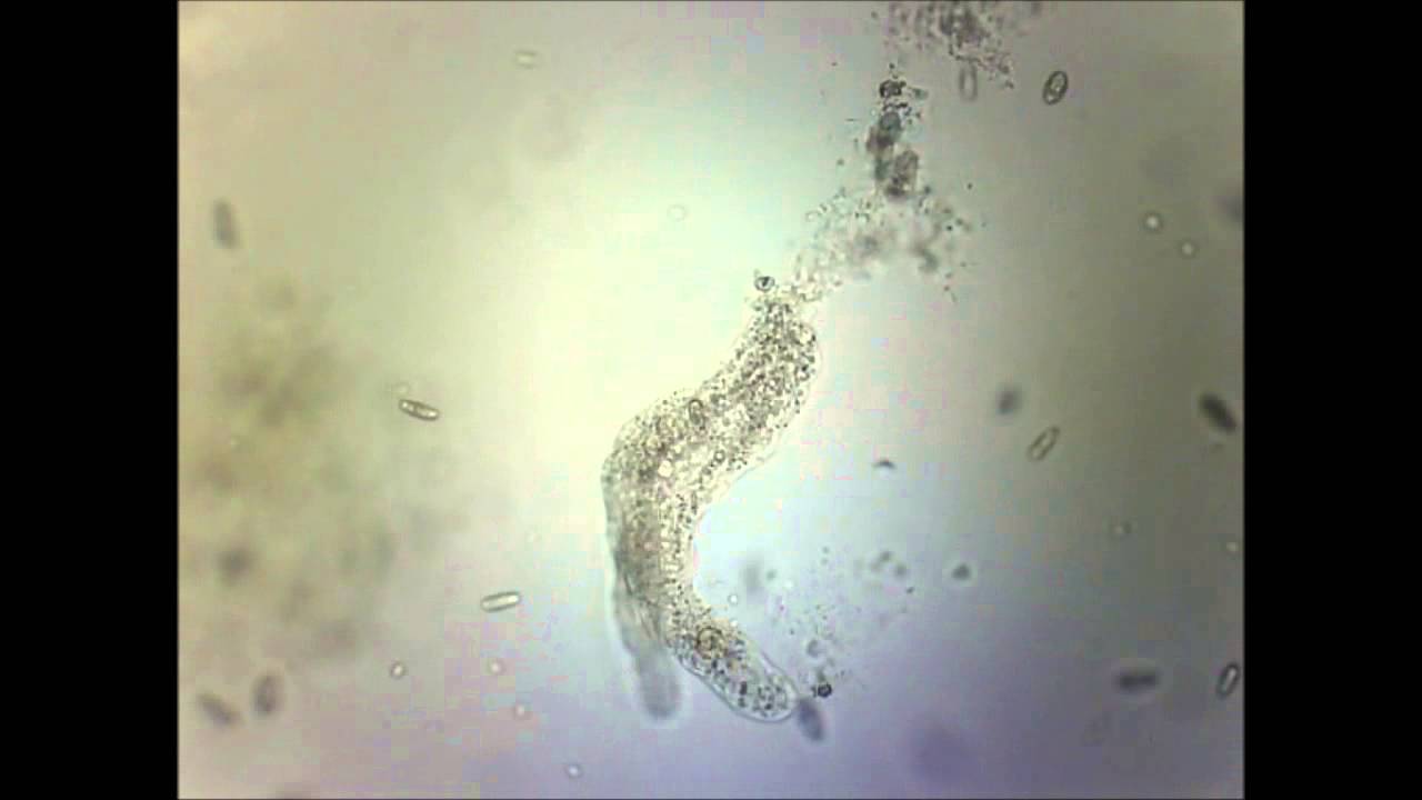 Time lapse Video : AMOEBA - YouTube