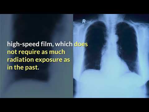 What are the risks of a chest X ray - YouTube