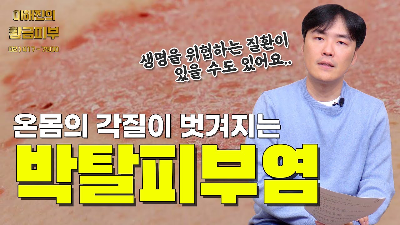 피부가 벗겨지고 발적이 생기는 질환 박탈피부염 연세에이앤비 피부과 이해진원장 Youtube