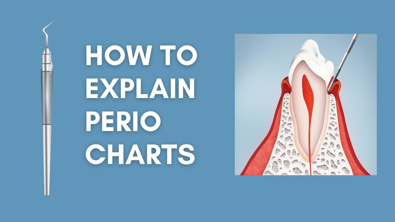 How to explain PERIO CHARTS - YouTube