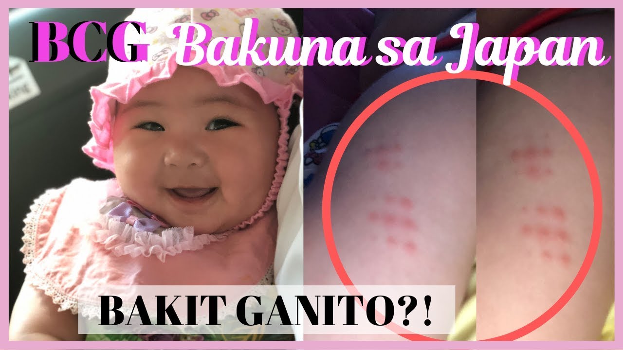 BCG VACCINE IN JAPAN | 18 NA NEEDLES?! | VLOG # 35 | PINAY IN JAPAN ...