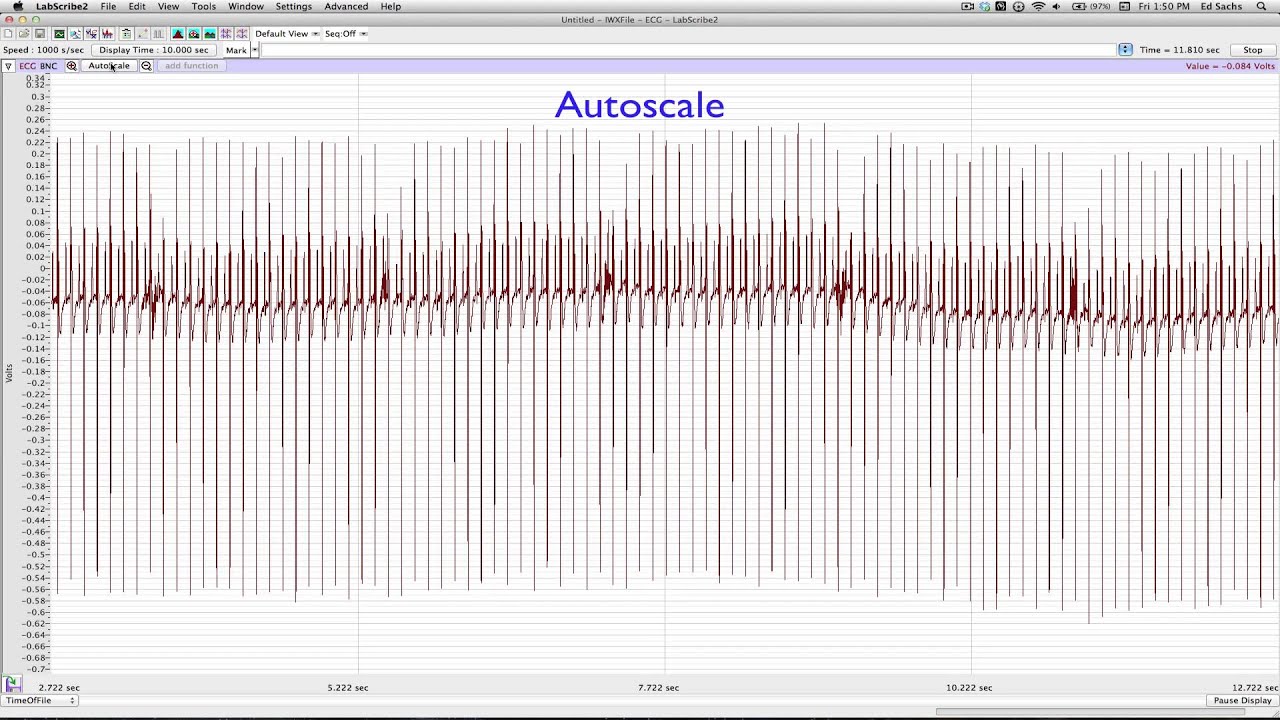 ECG 03 - ECG Recording - YouTube