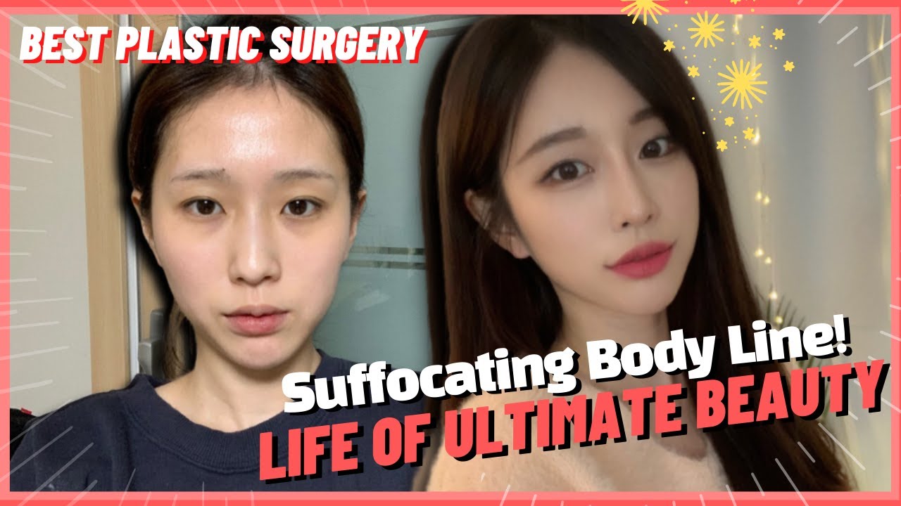 Life of an Ultimate Beauty after plastic surgery in Korea | DA Plastic ...